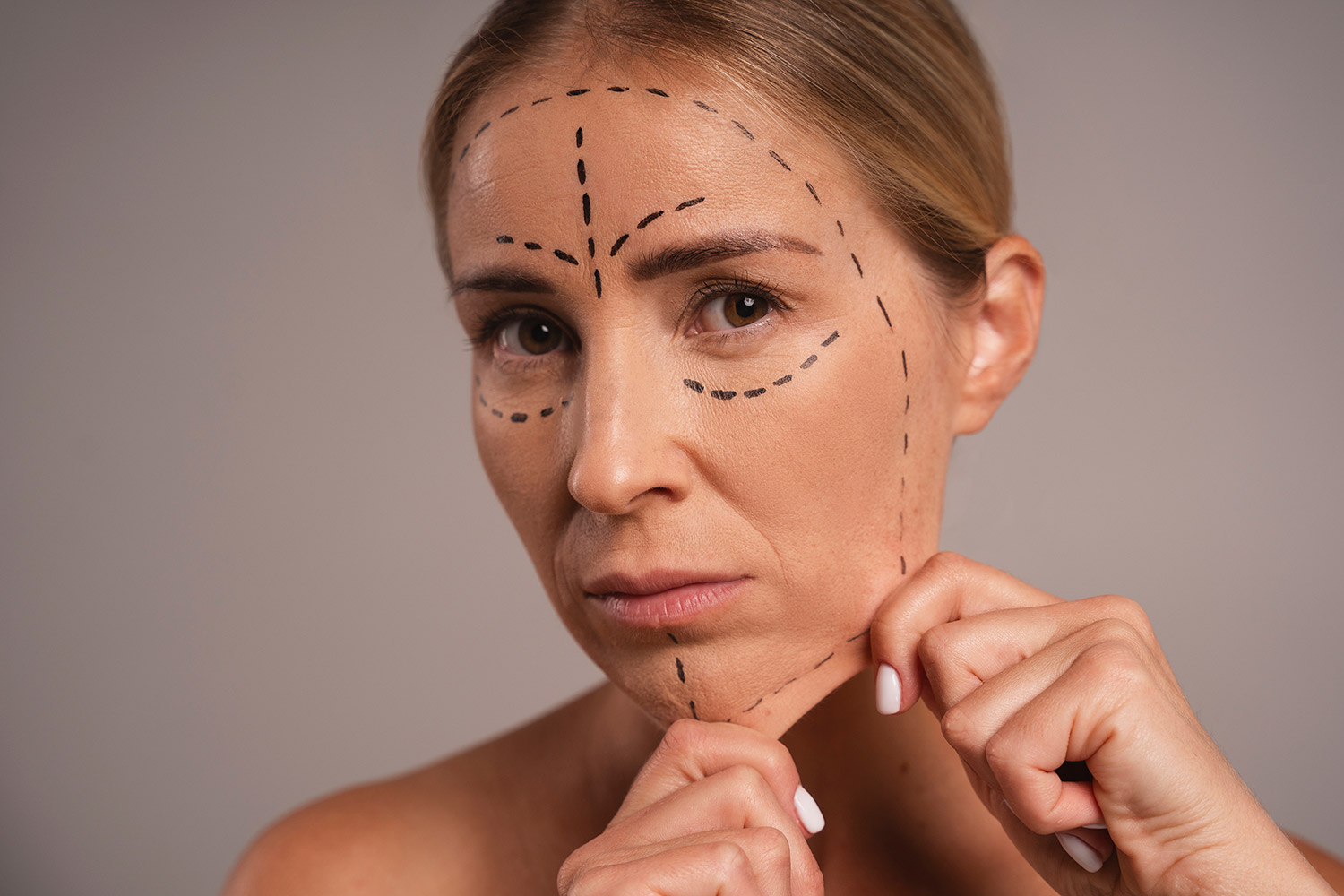 Flacidez Facial - O que é? Como prevenir? E Como tratar?